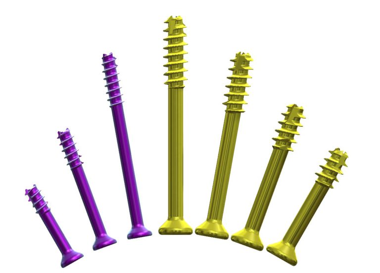 AURORA™ Screws - MiRus