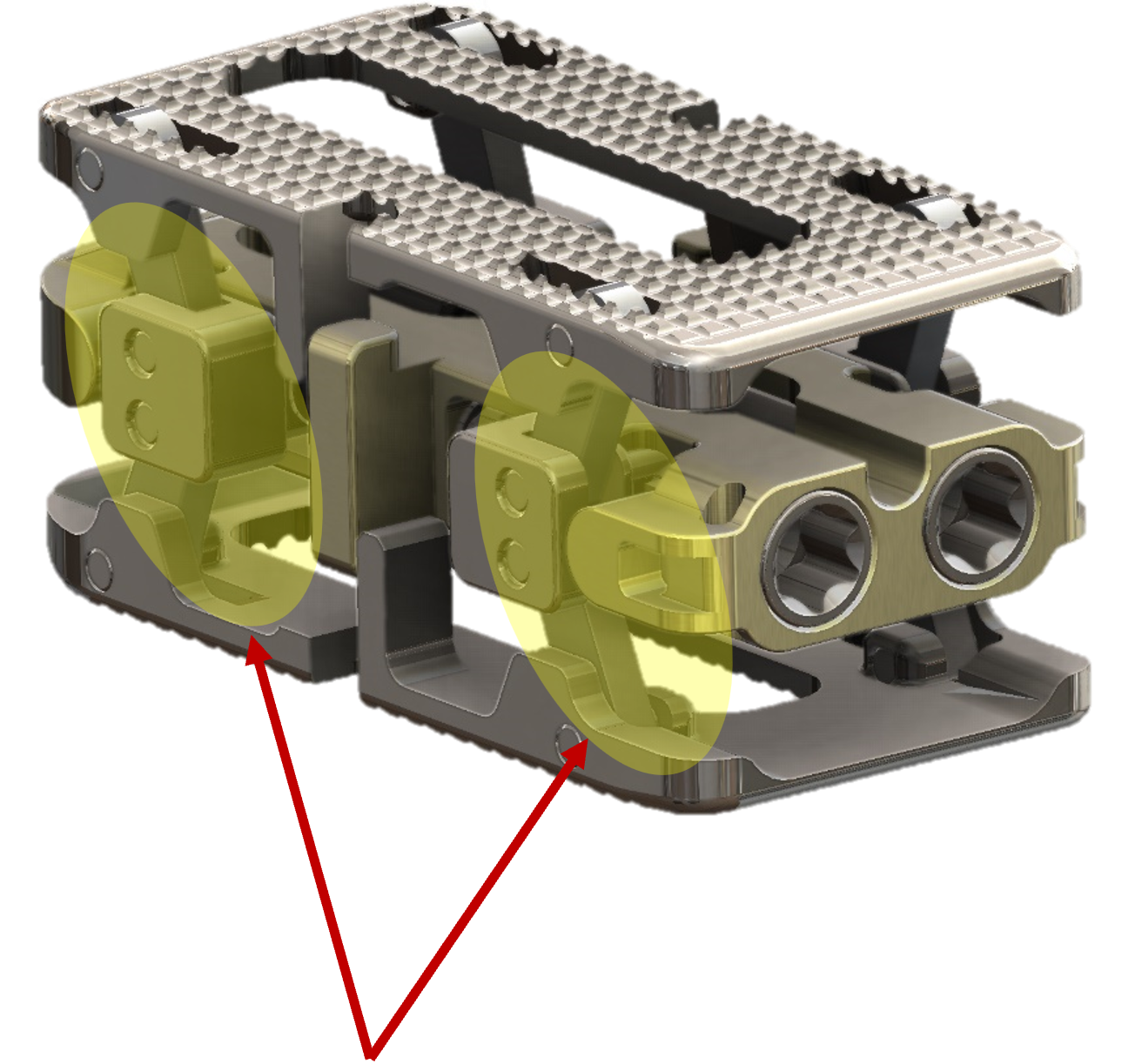 IO™ Lateral Expandable - MiRus
