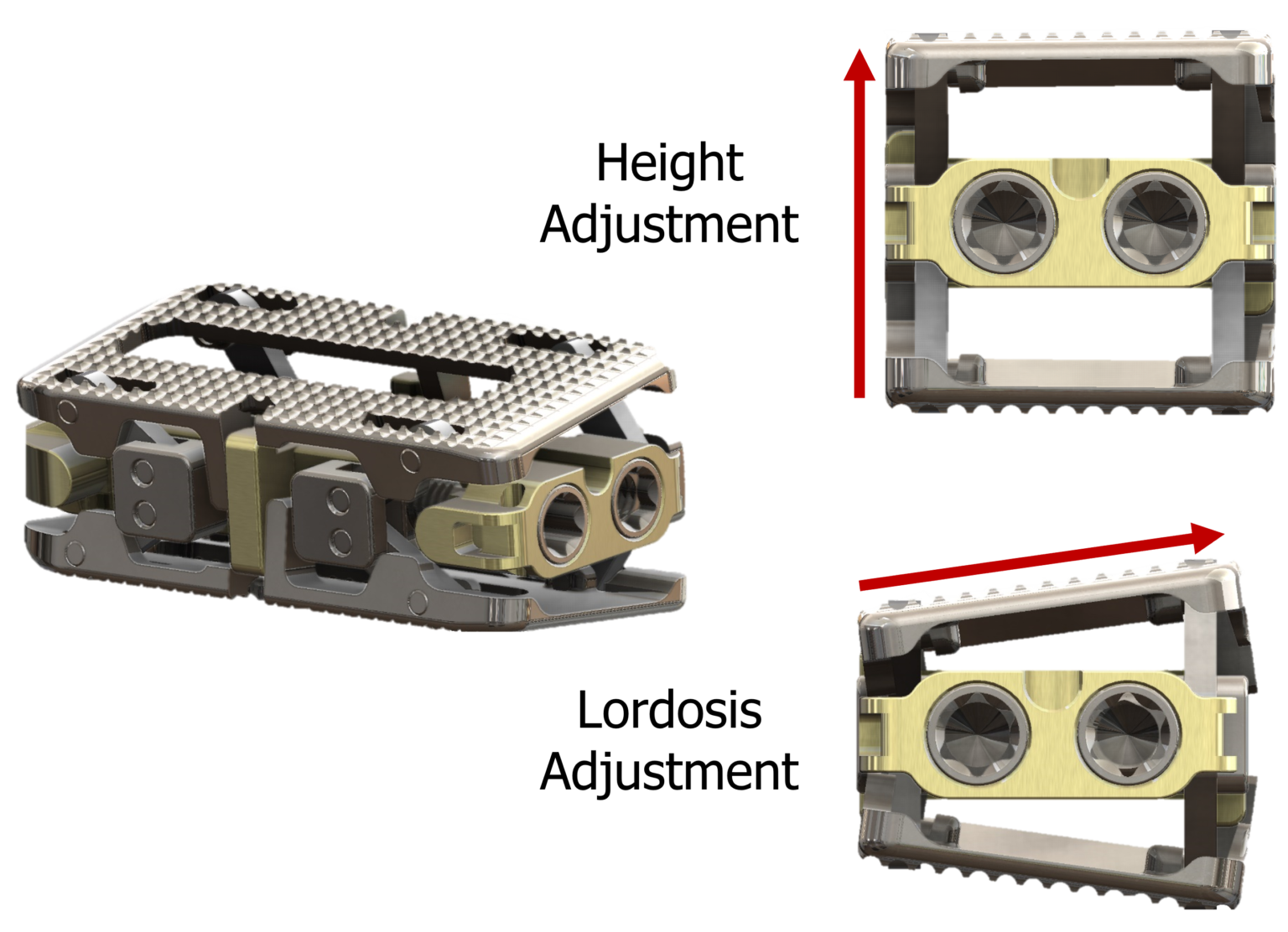 IO™ Lateral Expandable - MiRus