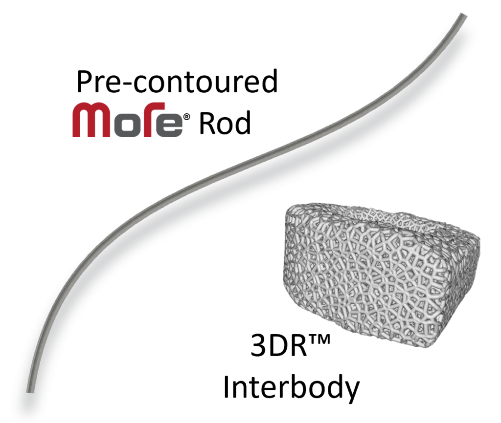 GALILEO™ Surgical Planning - MiRus