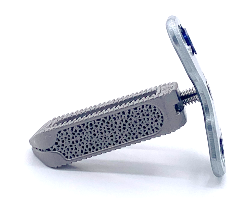 MoRe® Lumbar Plates - MiRus